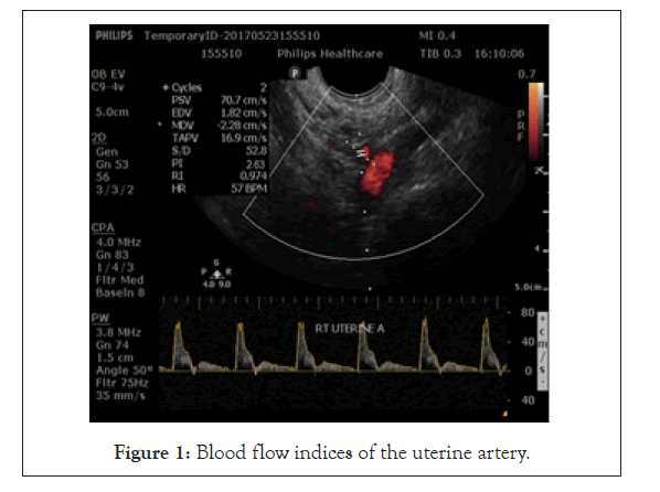 Uterine Tissue In Period Blood