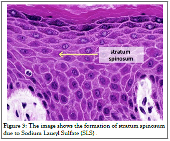 The Study of Sodium Lauryl Sulfate (SLS) Toxicity