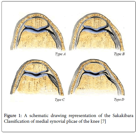 surgery-anesthesia-schematic-drawing